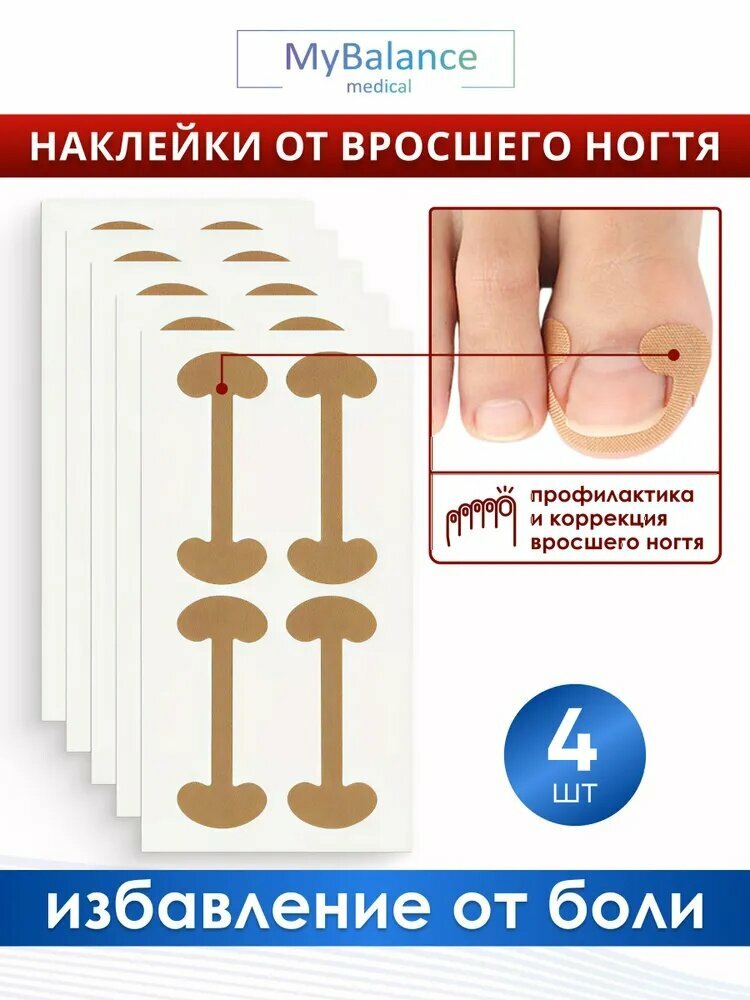 Наклейки от вросшего ногтя