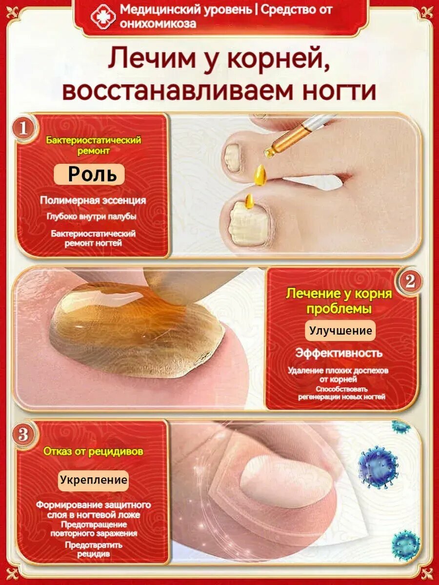 Средство от грибка ногтей на ногах / Крем для борьбы с несовершенствами / Мазь для ухода за ногами против онихолизиса