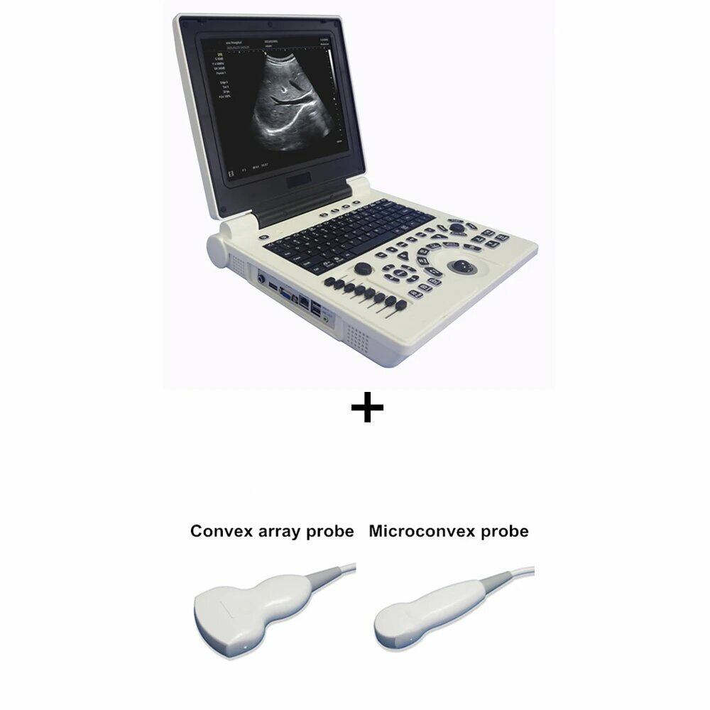 NESWELLMED Портативный ультразвуковой сканер USG Европейская вилка (EU Plug), convex-microconvex