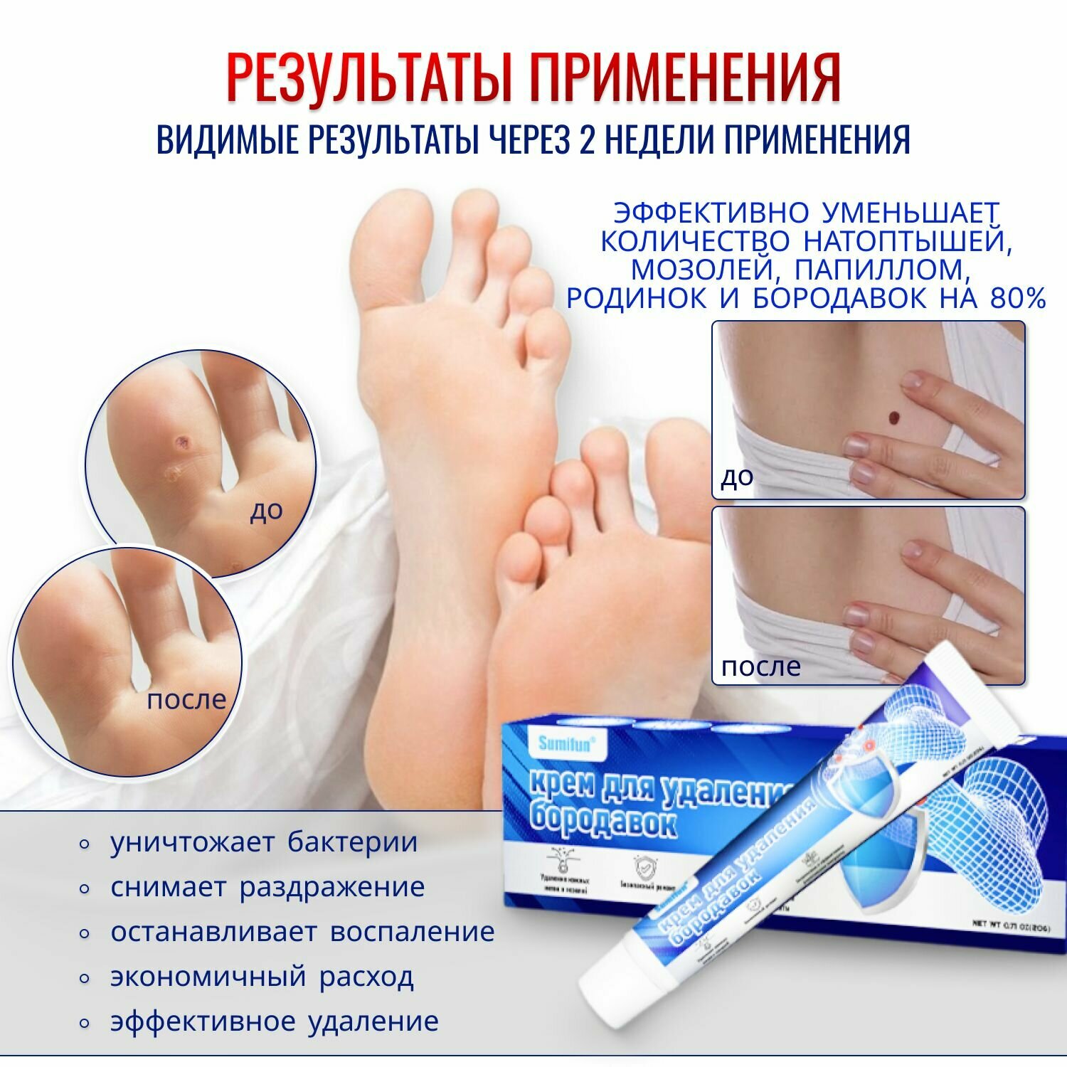 Средство для удаления натоптышей