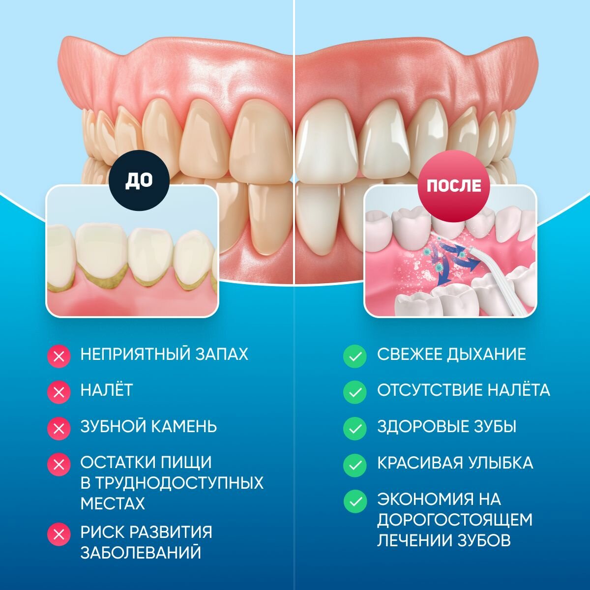 Ирригатор