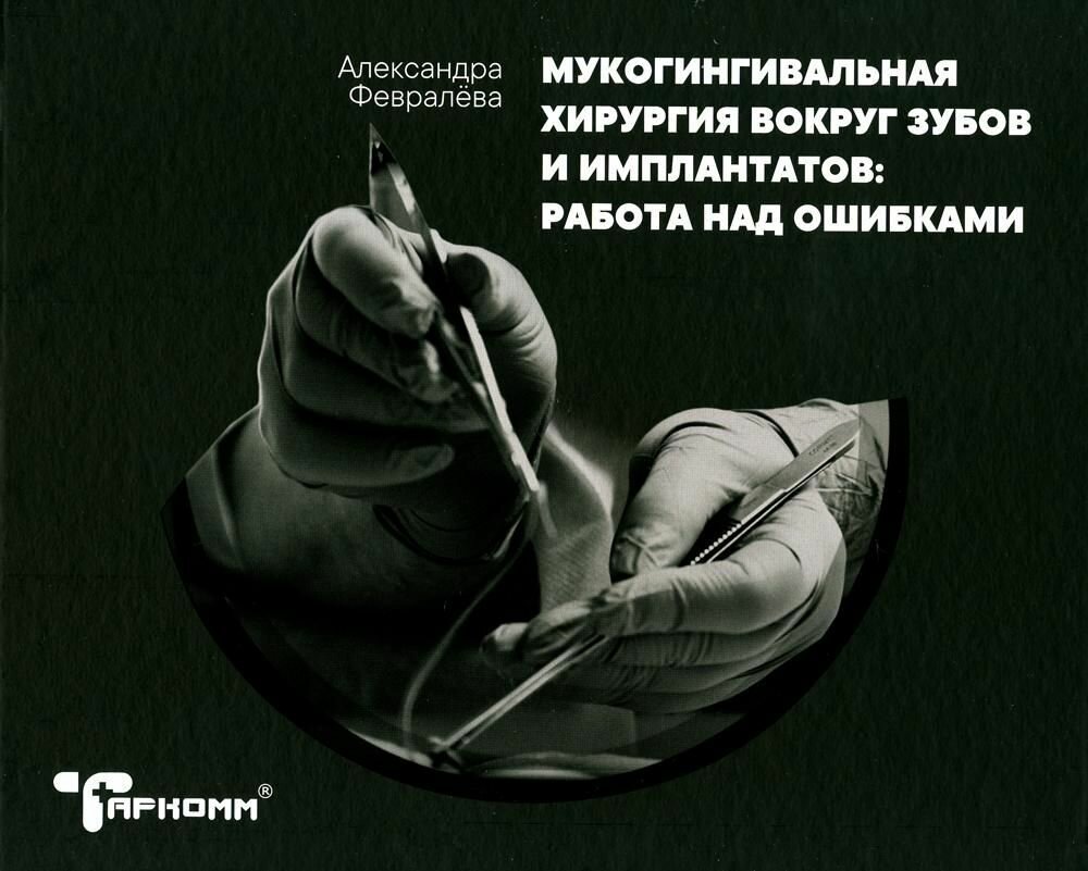 Мукогингивальная хирургия вокруг зубов и имплантатов: работа над ошибками. Февралева А. Ю.