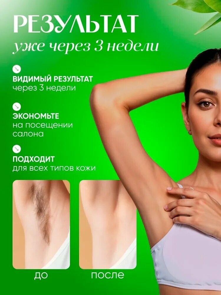 Фотоэпилятор, для удаления волос, для всего тела, белый, бронзовый
