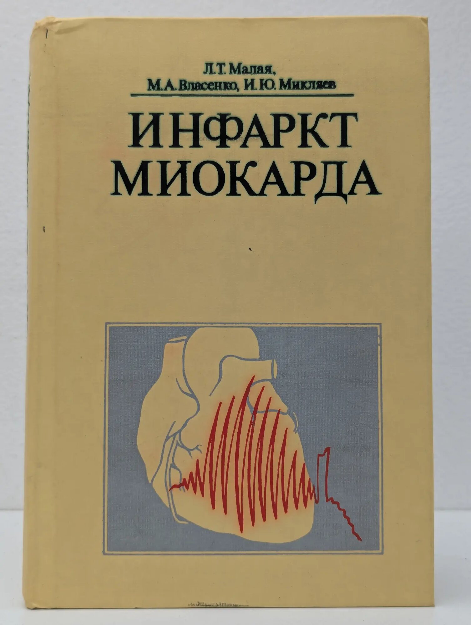 Инфаркт миокарда Малая Любовь Трофимовна, Микляев Илья Юрьевич 1981