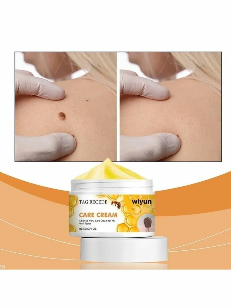 Пчелиный яд Средство от папиллом и бородавок, мазь для ухода за кожей, крем от родинок, папиллом и бородавок