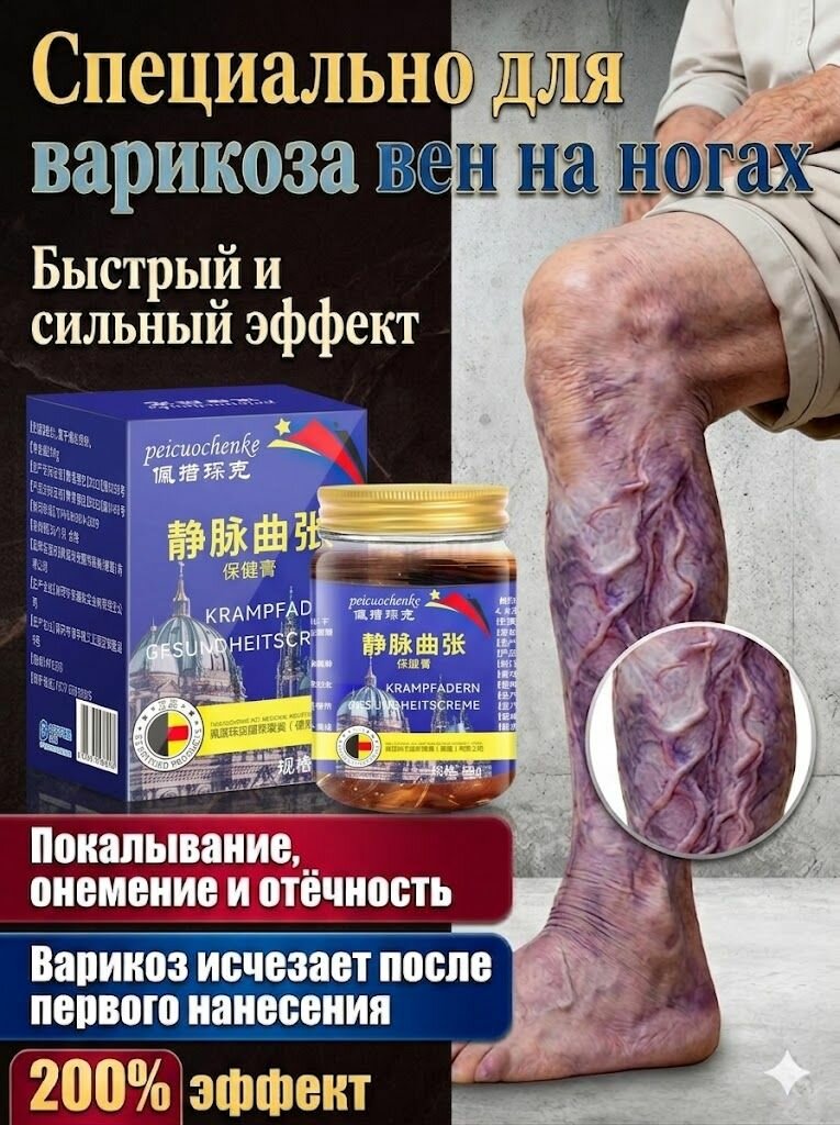 Мазь от варикоза вен на ногах
