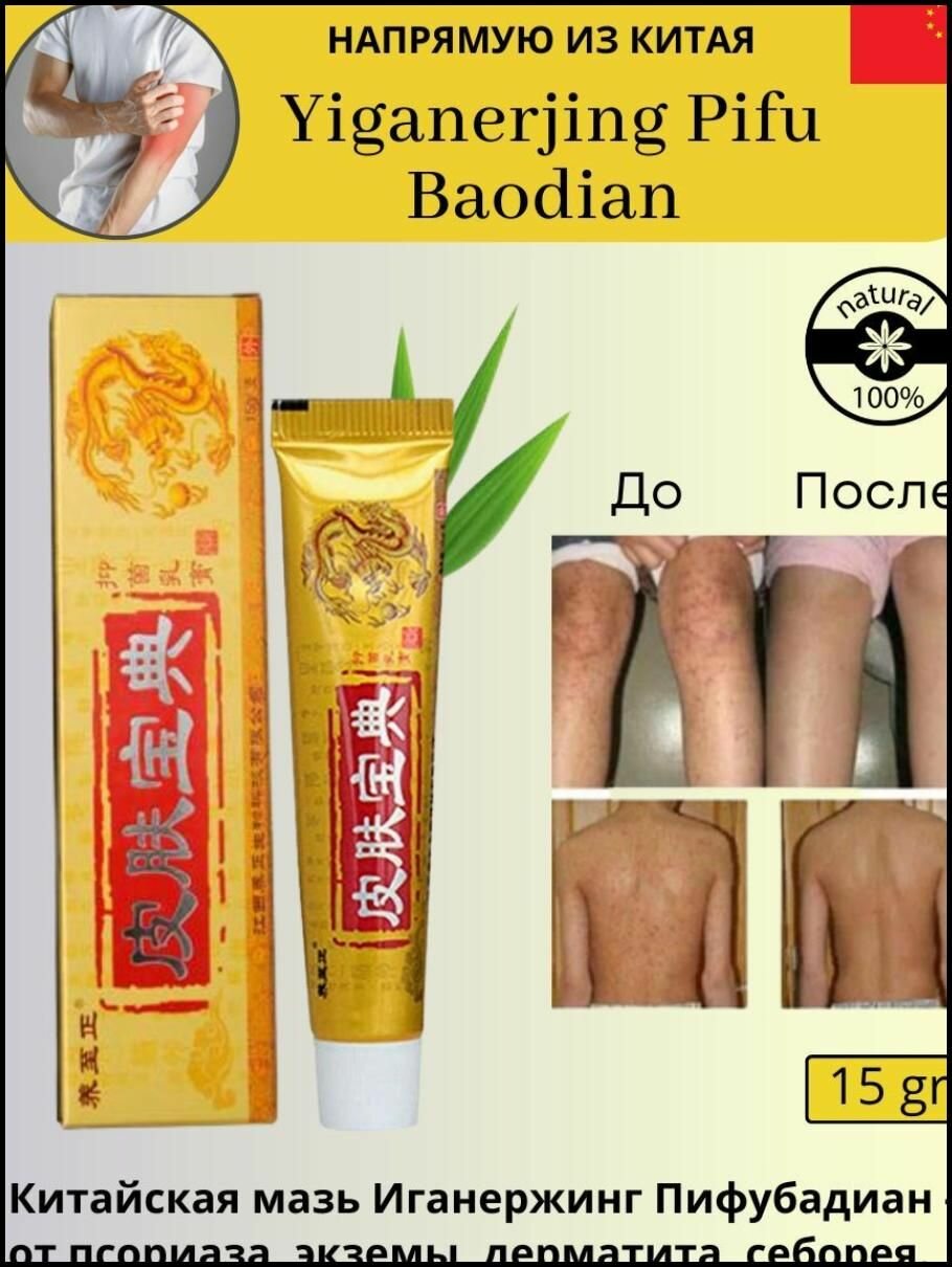 15 гр. Крем Pifu Baodian от псориаза, экземы, дерматита, потницы, зуда. Yiganerjing.