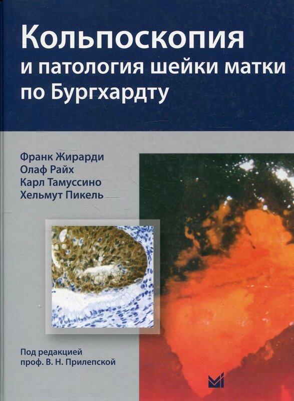 Кольпоскопия и патология шейки матки по Бургхардту (Жирарди Ф, Райх О, Такмуссино К.)