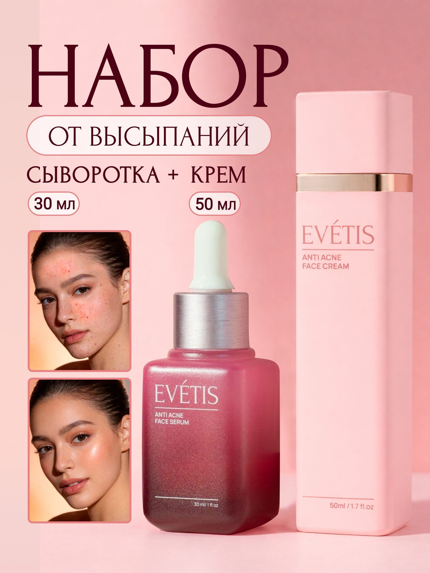EVETIS Набор крем и сыворотка от акне: против прыщей, для проблемной и жирной кожи лица