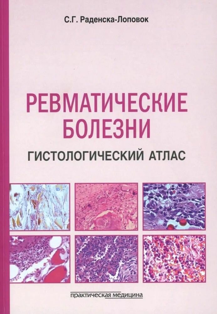 Ревматические болезни. Гистологический атлас. Раденска-Лоповок С. Г.