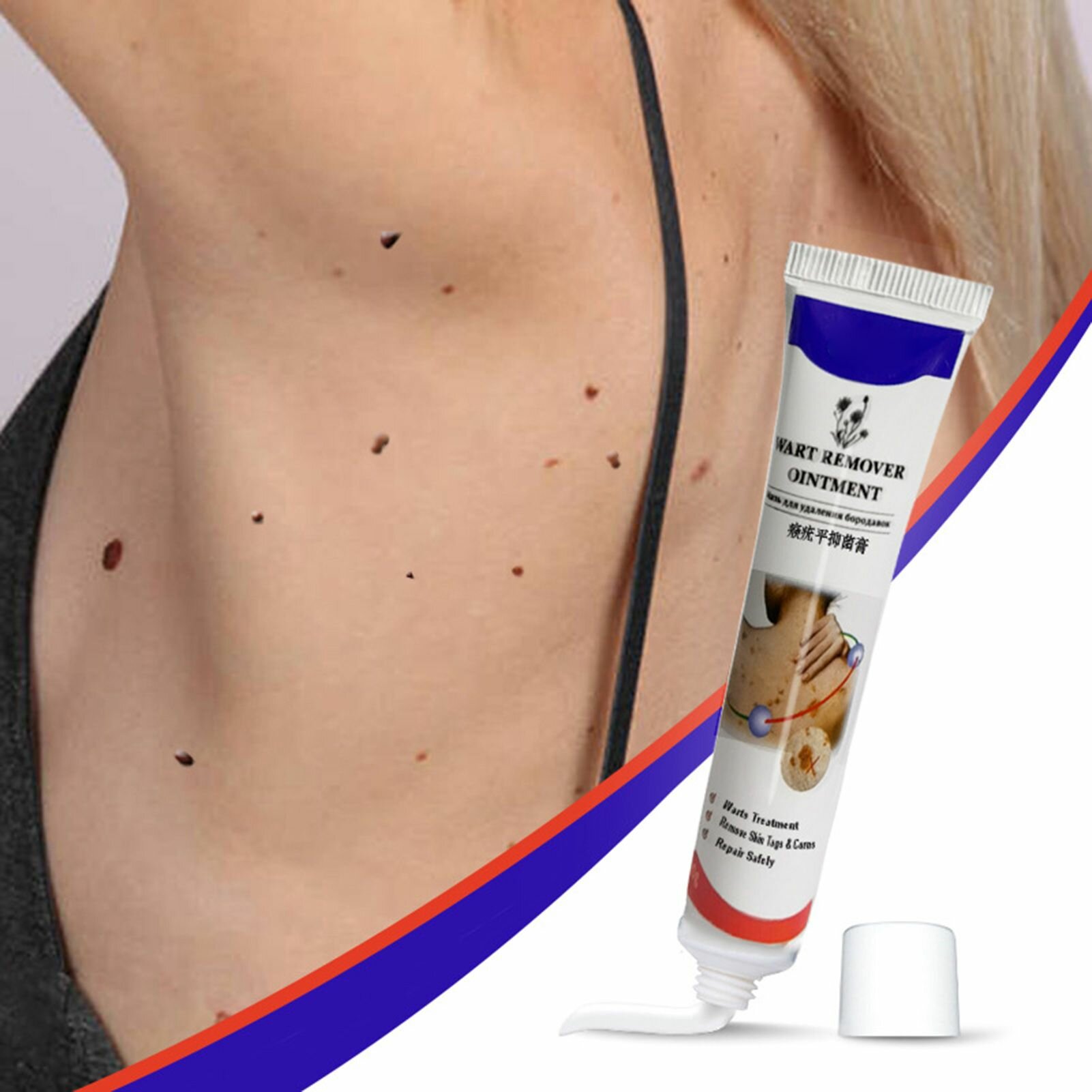 Крем от бородавок 20 г