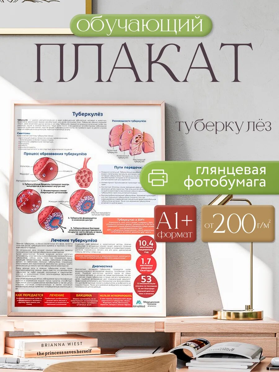 Туберкулёз медицинский плакат, глянцевая фотобумага от 200 г/кв. м, размер A1+