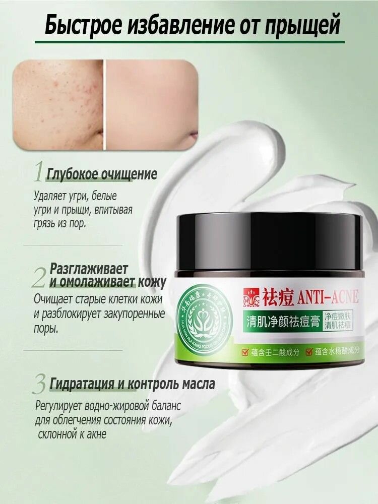 Против прыщей, от акне средство для подростков от прыщей на лице, для проблемной кожи, себорегулирующий.30мл