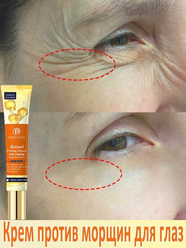 Крем для глаз век против морщин, припухлости, отеков и темных кругов с разглаживающим и антивозрастным эффектом, 20 мл