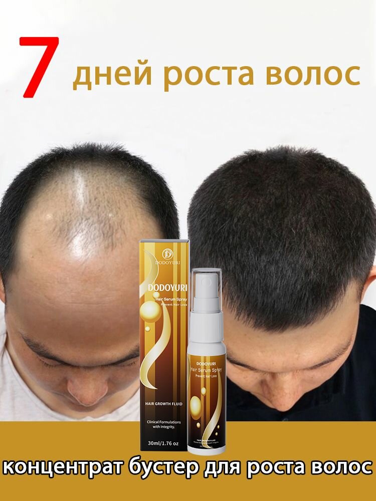 DODOYURI cыворотка для роста волос и бороды, средство против выпадения и для роста волос, Подходит для мужчин и женщин 30мл