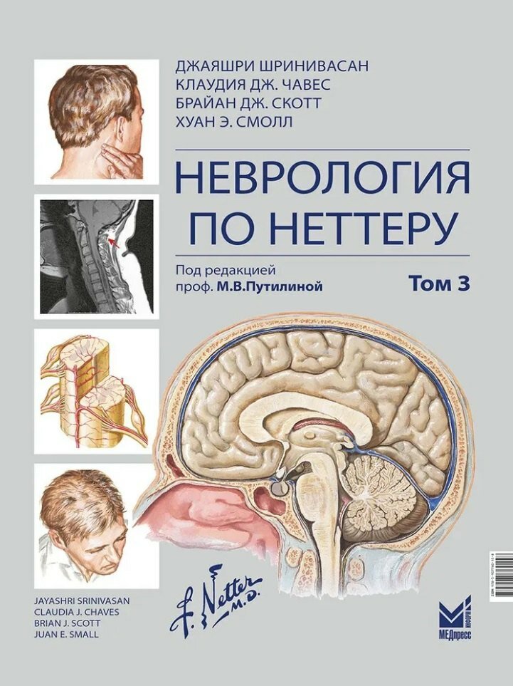 Неврология по Неттеру: В 3-х томах. Том 3