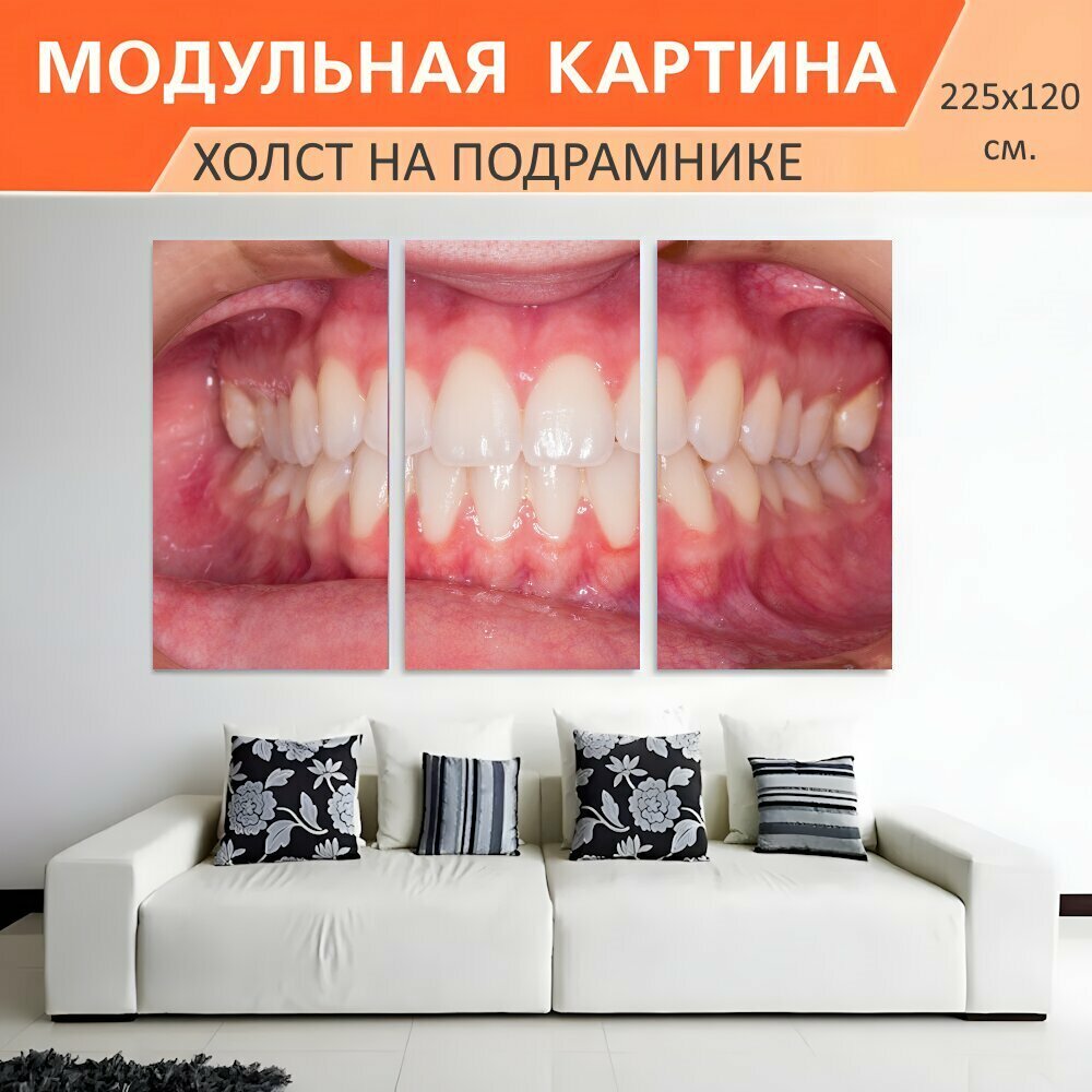 Модульная картина на холсте "Зубы, улыбка, дантист" триптих на подрамнике 225х120 см. для интерьера