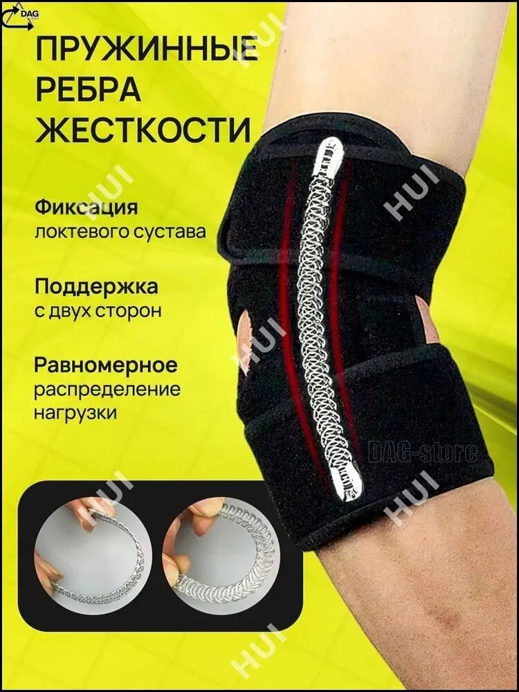 Защита локтя — фото 1