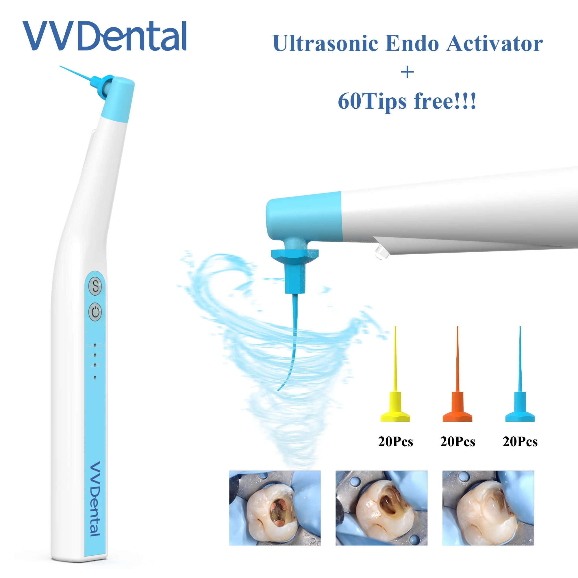 VV DENTAL Эндоактиватор со светодиодной подсветкой для корневых каналов 60 шт. Blue and 60 Tips