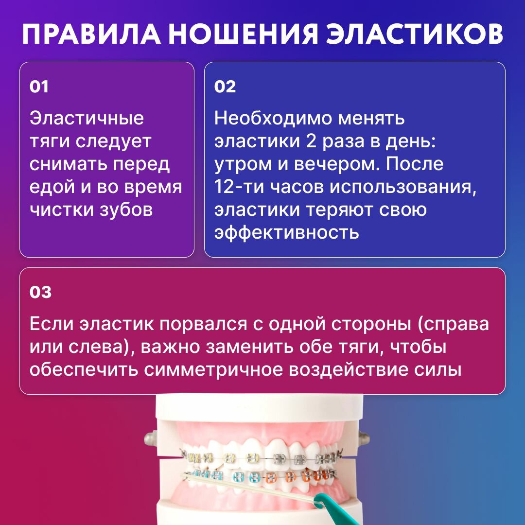 Эластичные лигатуры Лиса Ormco — фото 1