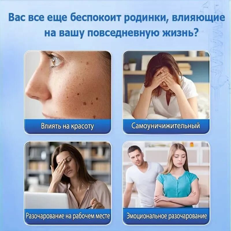 Средства от папиллом и бородавок, используемые для лечения ороговевшей кожи, удаления сухих мозолей на ногах и теле, натуральные растительные ингредиенты, 20 грамм