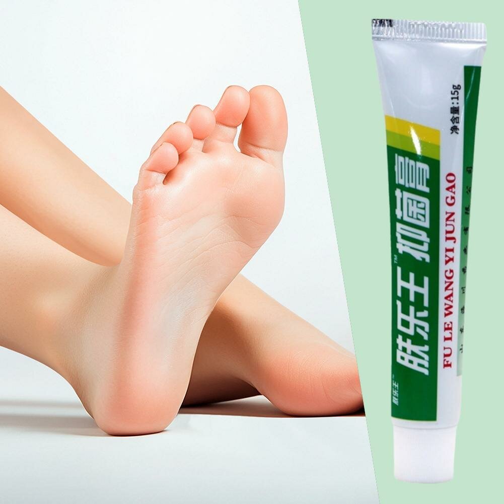 Китайская чудо мазь Ван Юэ от псориаза, экземы, дерматита, герпеса, акне, прыщей