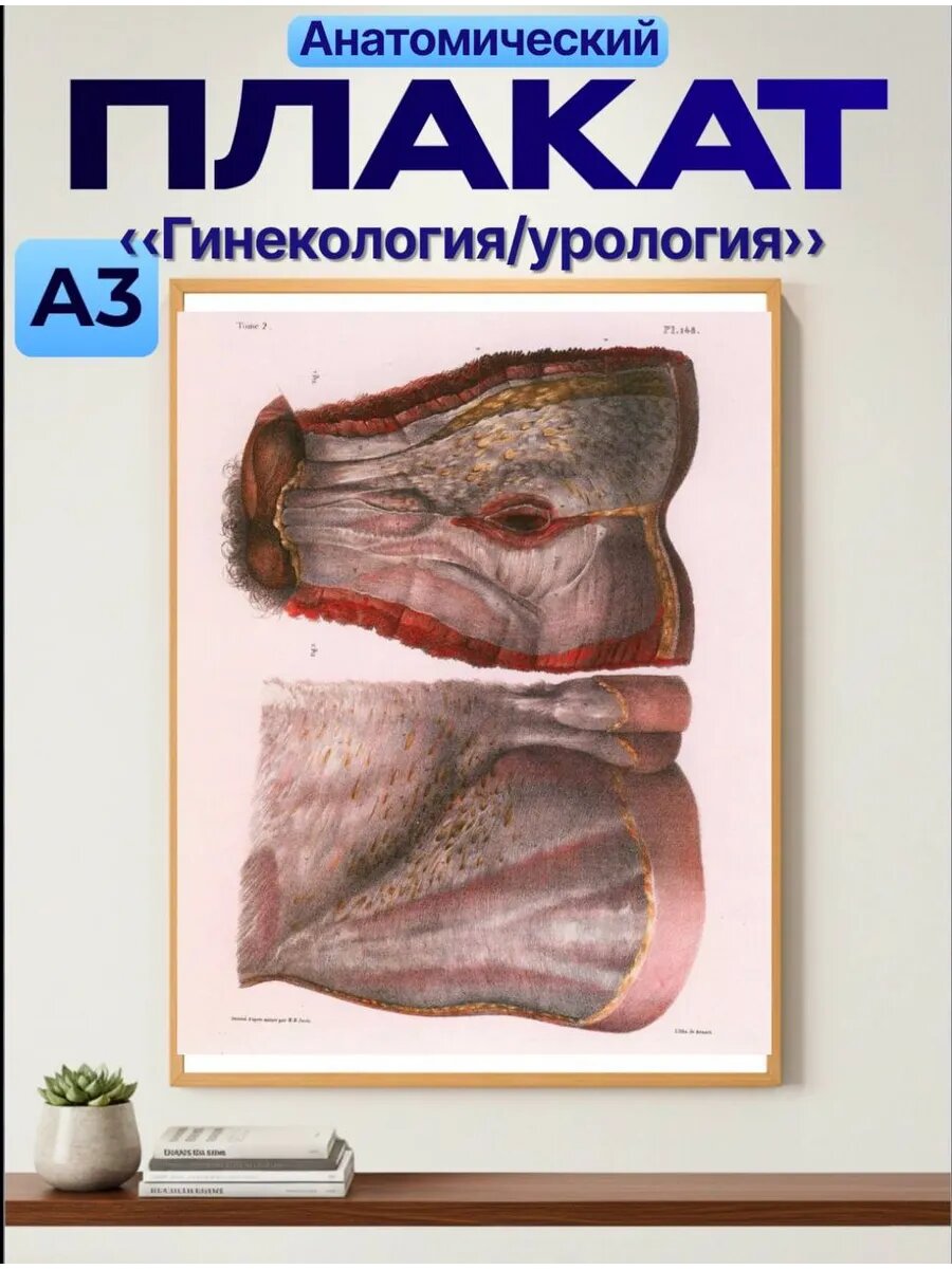 Постер медицинский, машонка, урология гинекология, А3 анатомия, хирургия