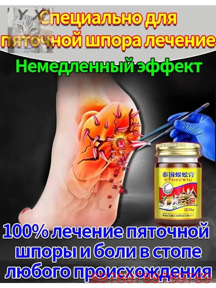 MS STORE Крем-мазь для лечения пяточной шпоры и боли в стопе, 55 г