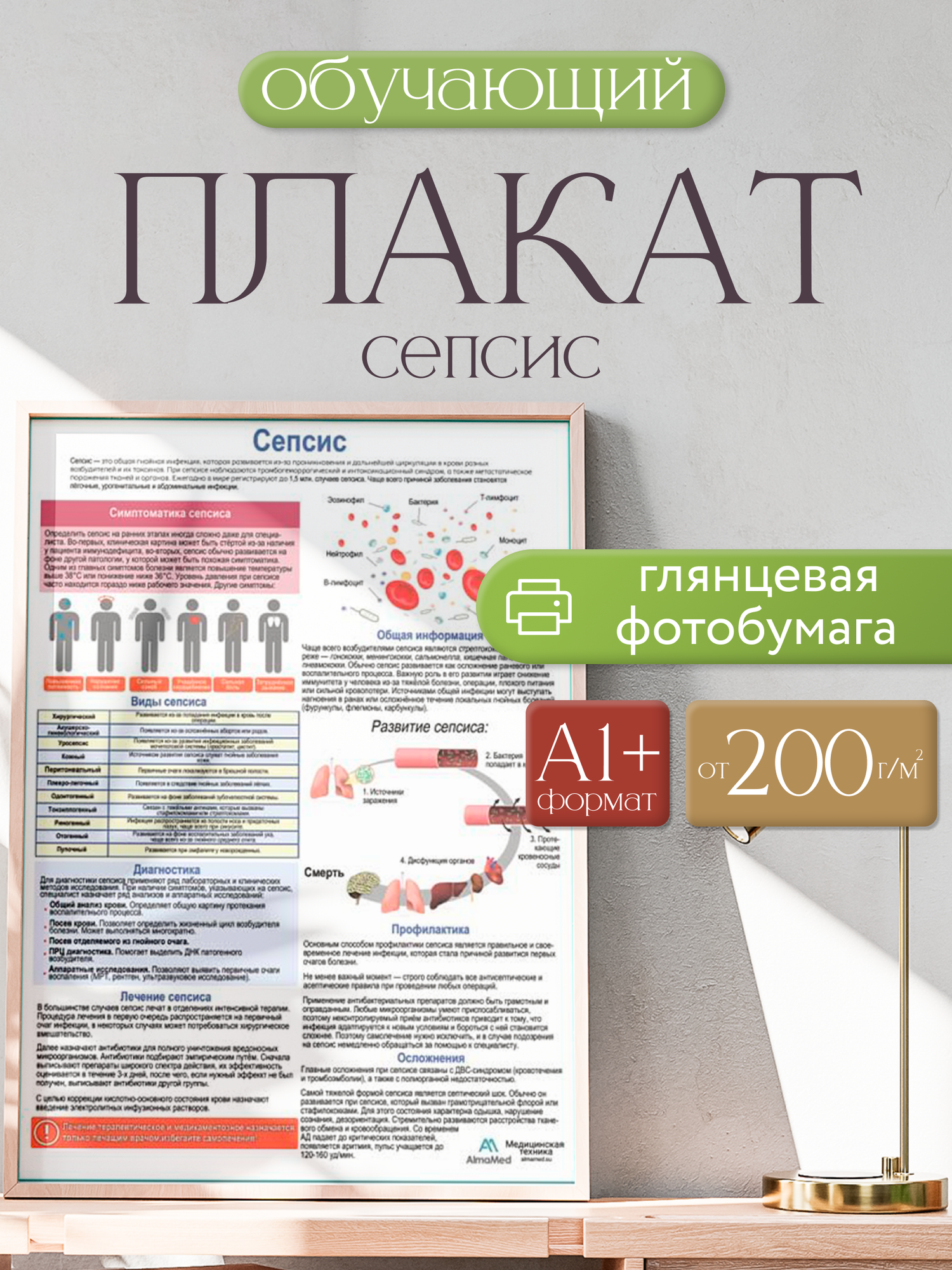 Обучающий плакат "Сепсис", размер А1+, глянцевая фотобумага от 200г/м2