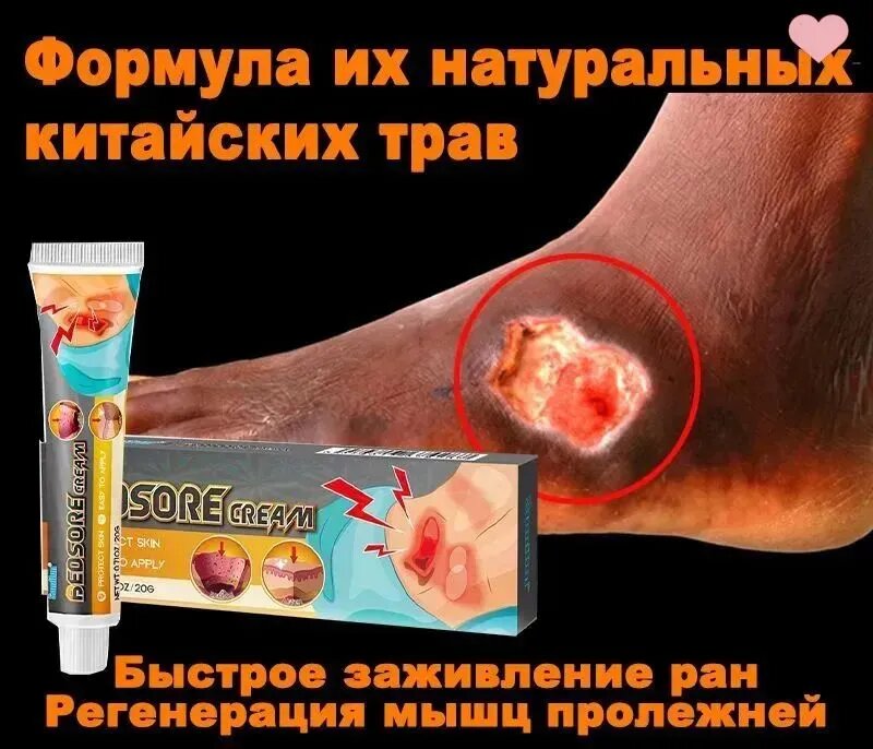 Мазь от пролежней регенерирующая 20г, при покраснениях, язвах и открытых ранах, Быстрое заживление для лежачих больных, после операций и у пожилых.