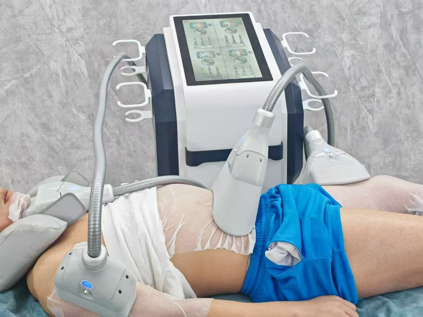 Аппарат для криолиполиза CRYO ZERO, 6 в 1, белый/синий, с экраном