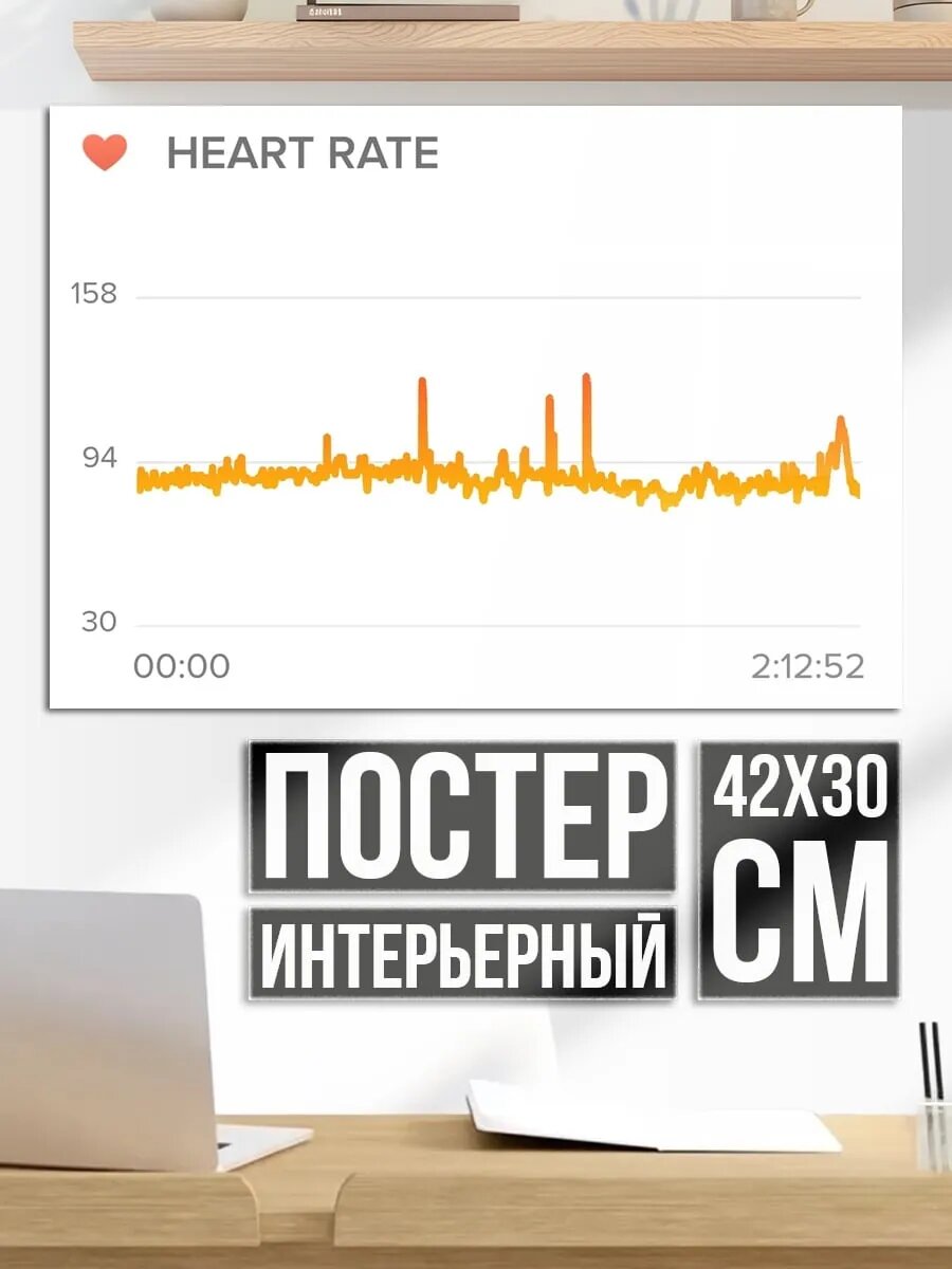 Плакат постер График сердечного ритма