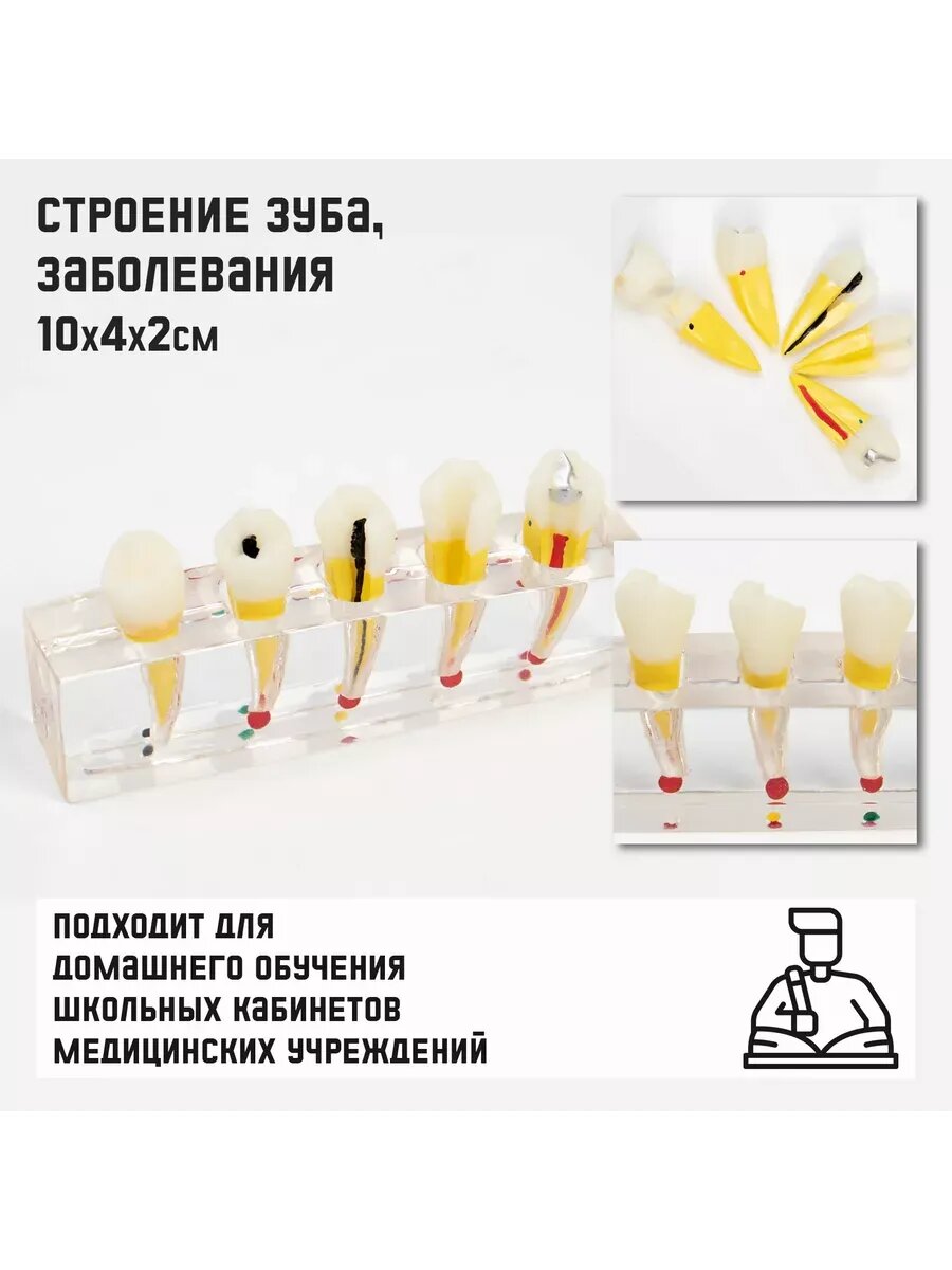 Макет Строение зуба