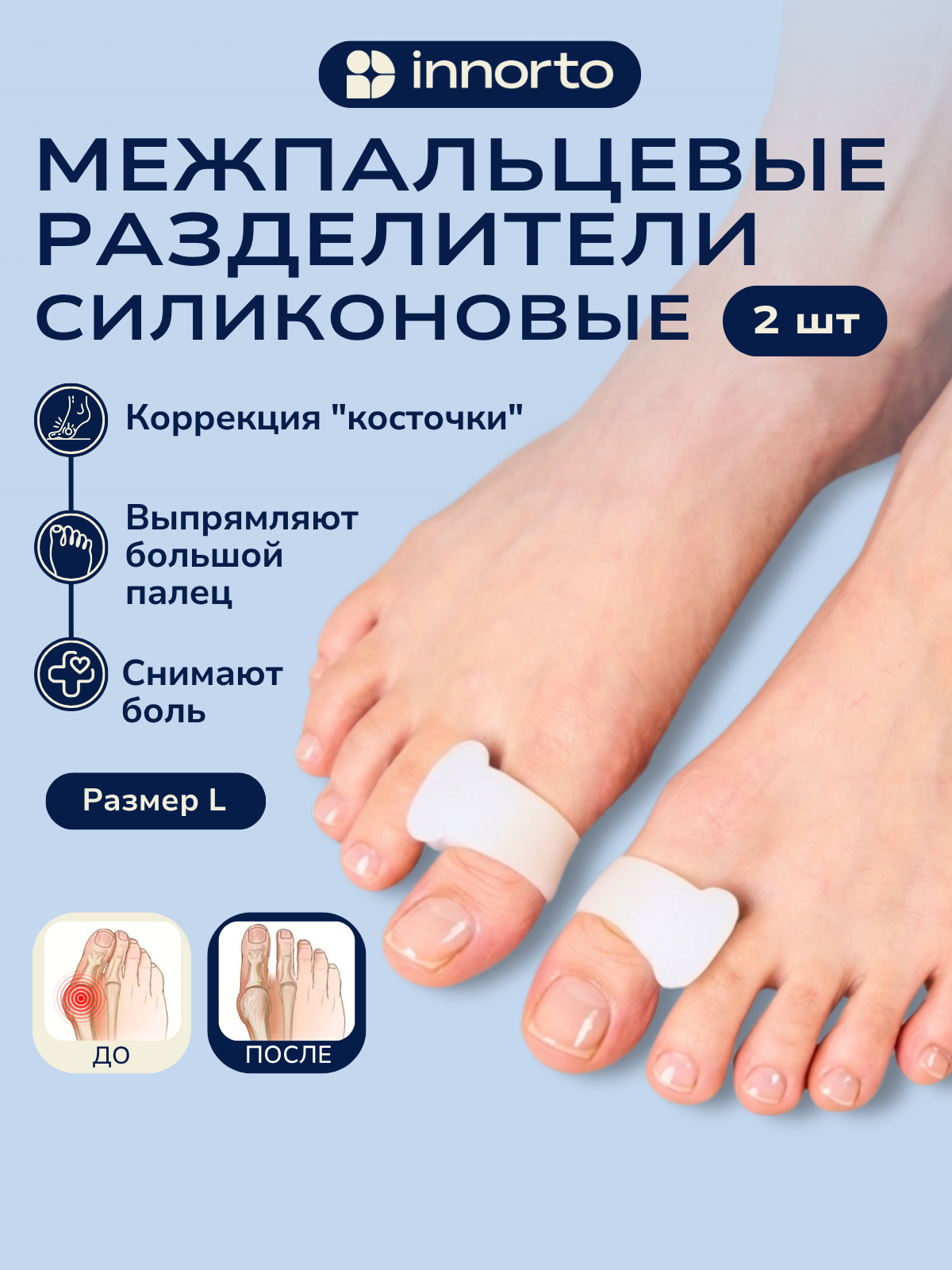 Разделители «INNORTO», артикул 44483, типоразмеры L - 1 пара;