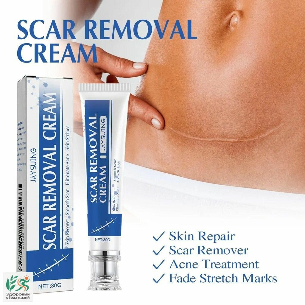 Крем от шрамов и растяжек Fast Scar выравнивание кожи, удаление рубцов CO712