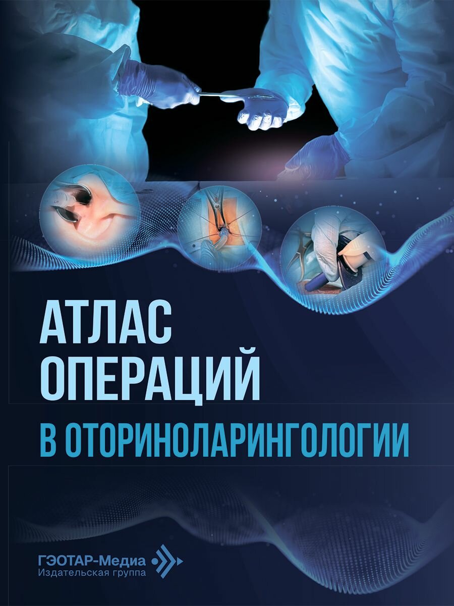 Атлас операций в оториноларингологии. Хирургические вмешательства на ЛОР - органы. Наглядный учебник хирургам - оториноларингологам