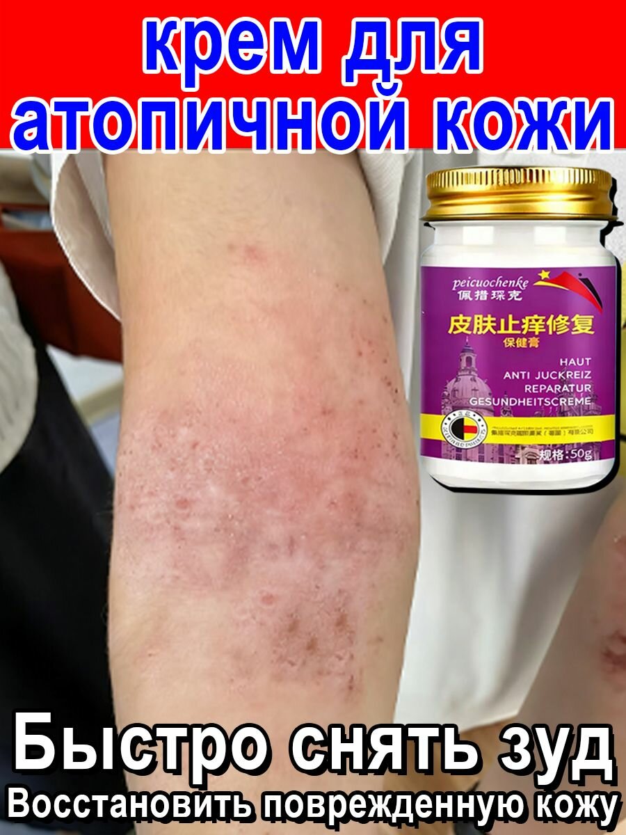 Крем для сухой и атопичной кожи