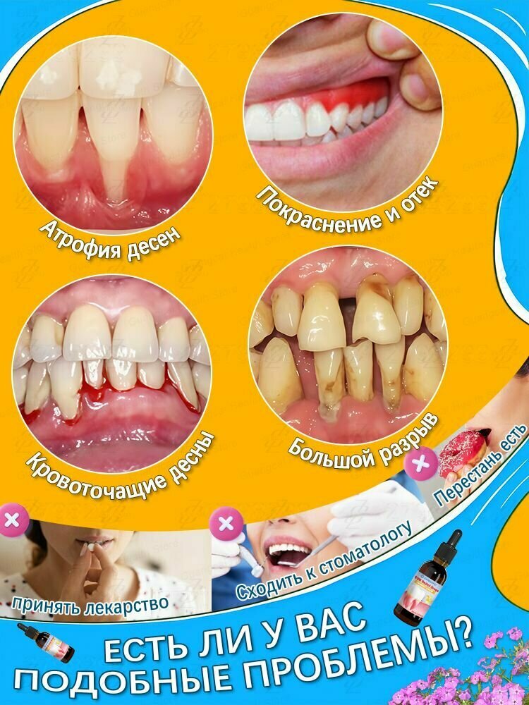 Масло для ухода за полостью рта при рецессии десен, повышенной чувствительности зубов, стоматите и для ухода за деснами. Укрепляет зубную эмаль.30 мл