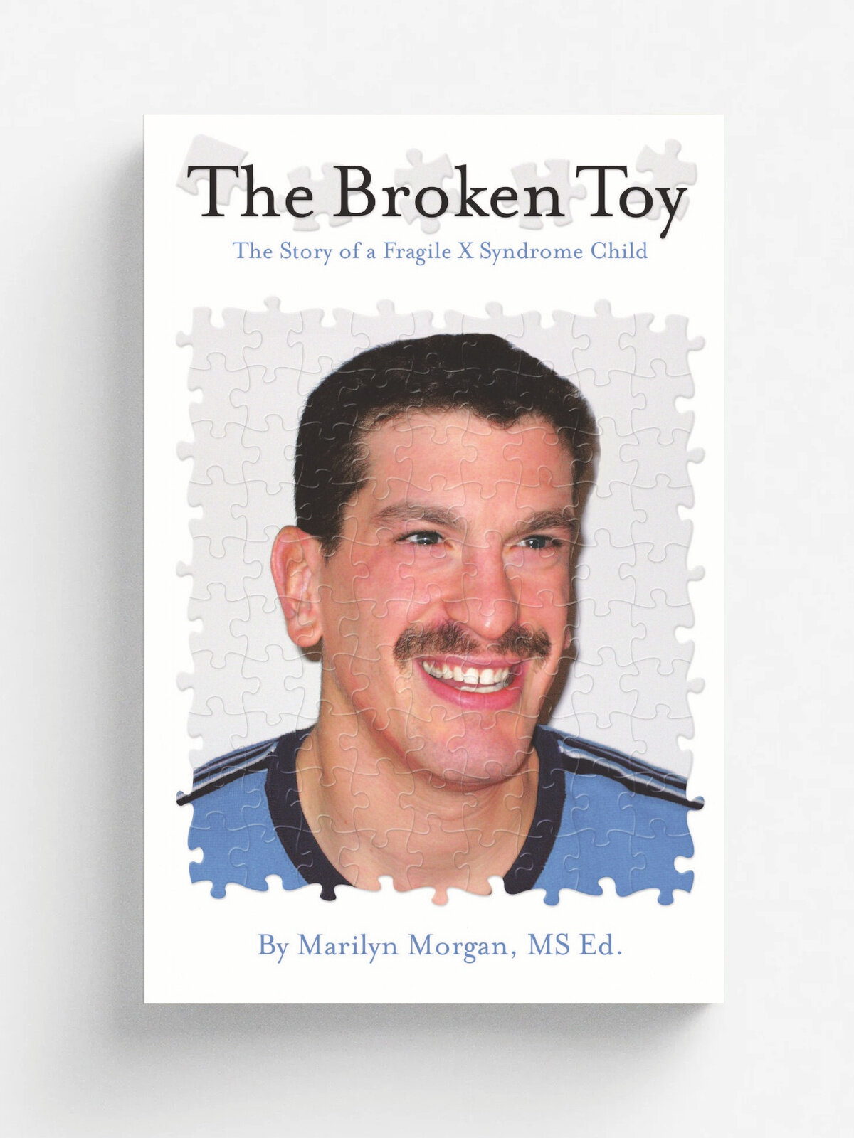 The Broken Toy. A Story of a Fragile X Syndrome Child