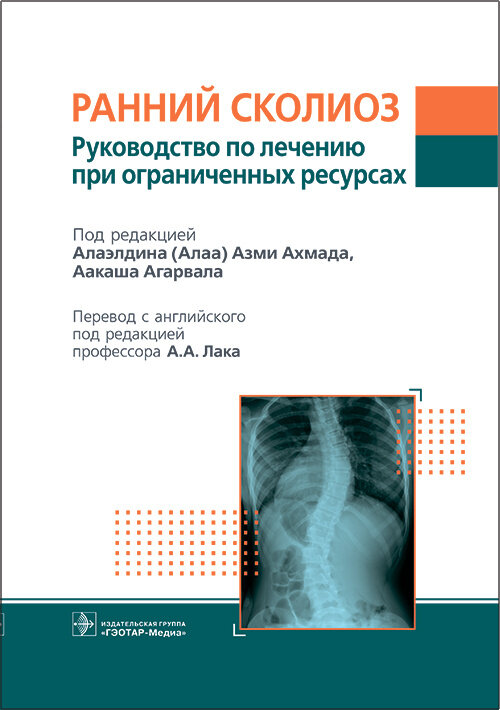 Ранний сколиоз. Руководство по лечению при ограниченных ресурсах / под ред. Алаэлдина (Алаа) Азми Ах