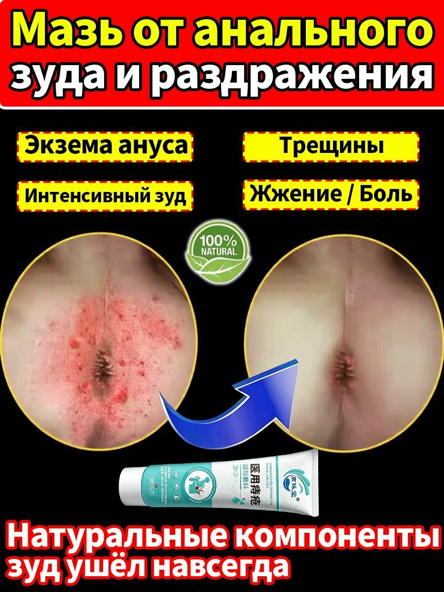 Крем от зуда в заднем проходе, быстрое облегчение 20 г