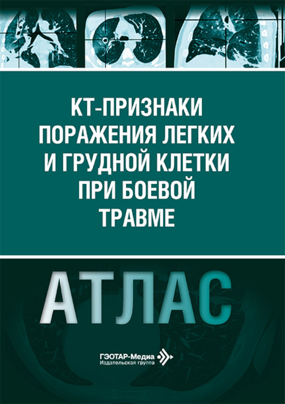 КТ-признаки поражения легких и грудной клетки при боевой травме: атлас. Кошурников Д. С, Тополянская С. В, Рачина С. А.