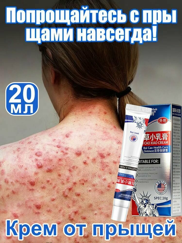 Мазь от угрей и прыщей, для тела Acne Free , прыщей акне и воспалений, для ухода за кожей, 20мл