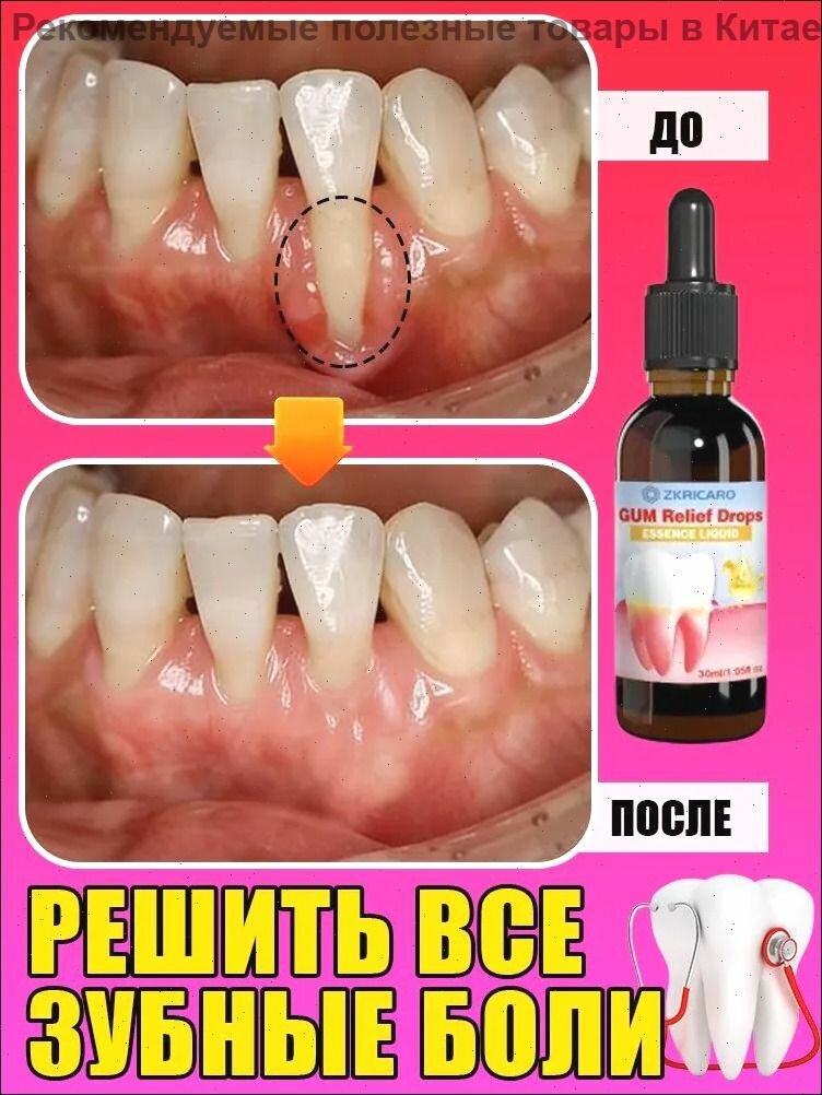 Масло для десен при воспалениях в полости, укрепления дёсен и снижения кровоточивости, Быстро лечит опухшие, лечение пародонтита и гингивита, Чистое дыхание, комплексный уход + защита дёсен,30мл