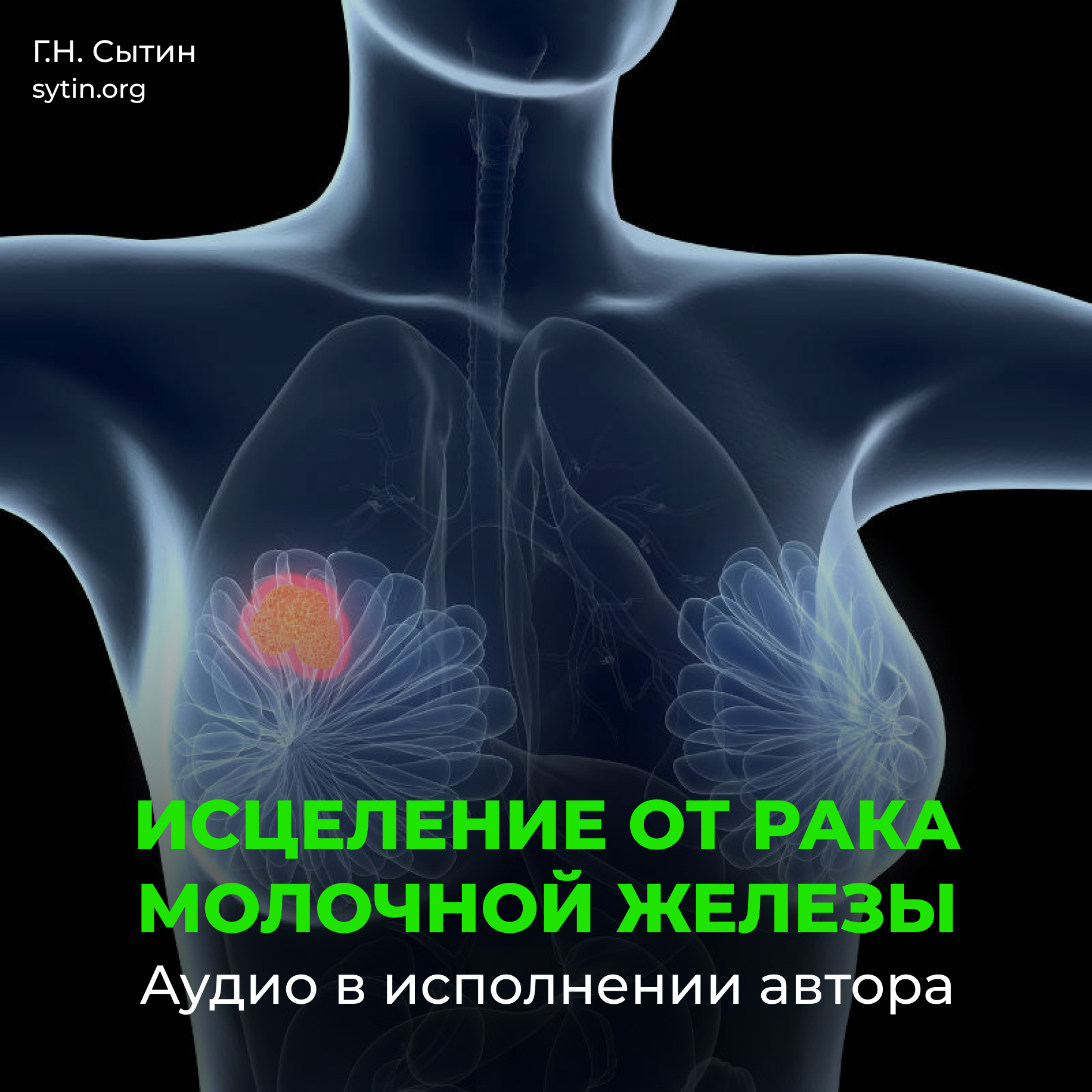 Настрой рак молочной железы , Георгий Николаевич Сытин, MP3, 2 аудиозаписи