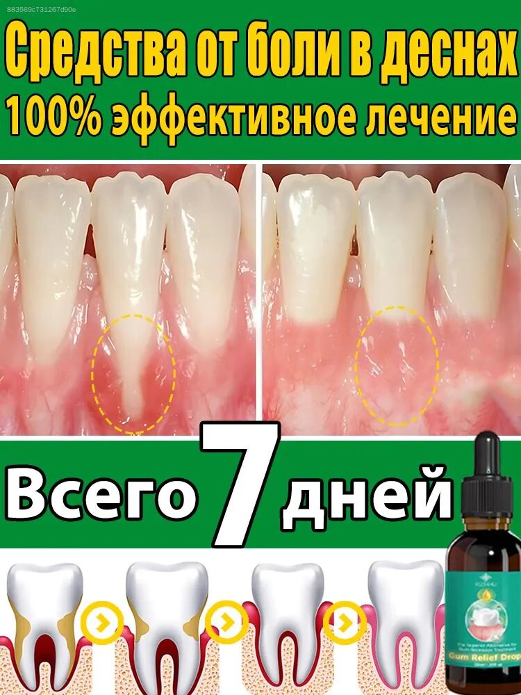 Используется для лечения пародонтита, стоматита, снятия чувствительности и отека десен, восстановления, профилактики и укрепления поврежденных десен, Гигиена полости рта, 30 мл, 1 флакон