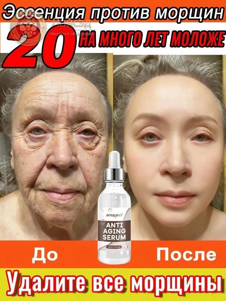 Сыворотка против морщин. сыворотка для лица, Избавьтесь от морщин. Борется со старением, осветлите темные круги и мешки под глазами, подходит для людей старше 30+. 30 мл