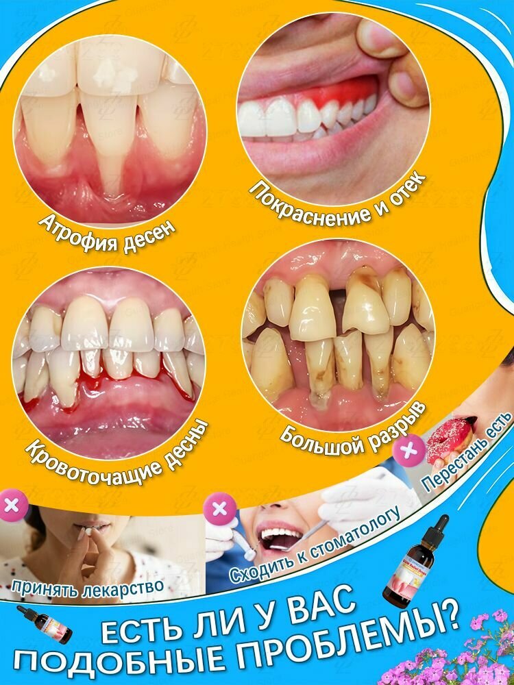 Масло для ухода за полостью рта при рецессии десен, повышенной чувствительности зубов, стоматите и для ухода за деснами. Укрепляет зубную эмаль.30 мл