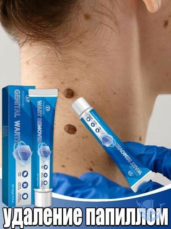 LUKAOHUA / Мазь от бородавок, Крем средство для удаления бородавок, папиллом и родинок, безболезненно, не оставляет следов без побочных эффектов / 20г