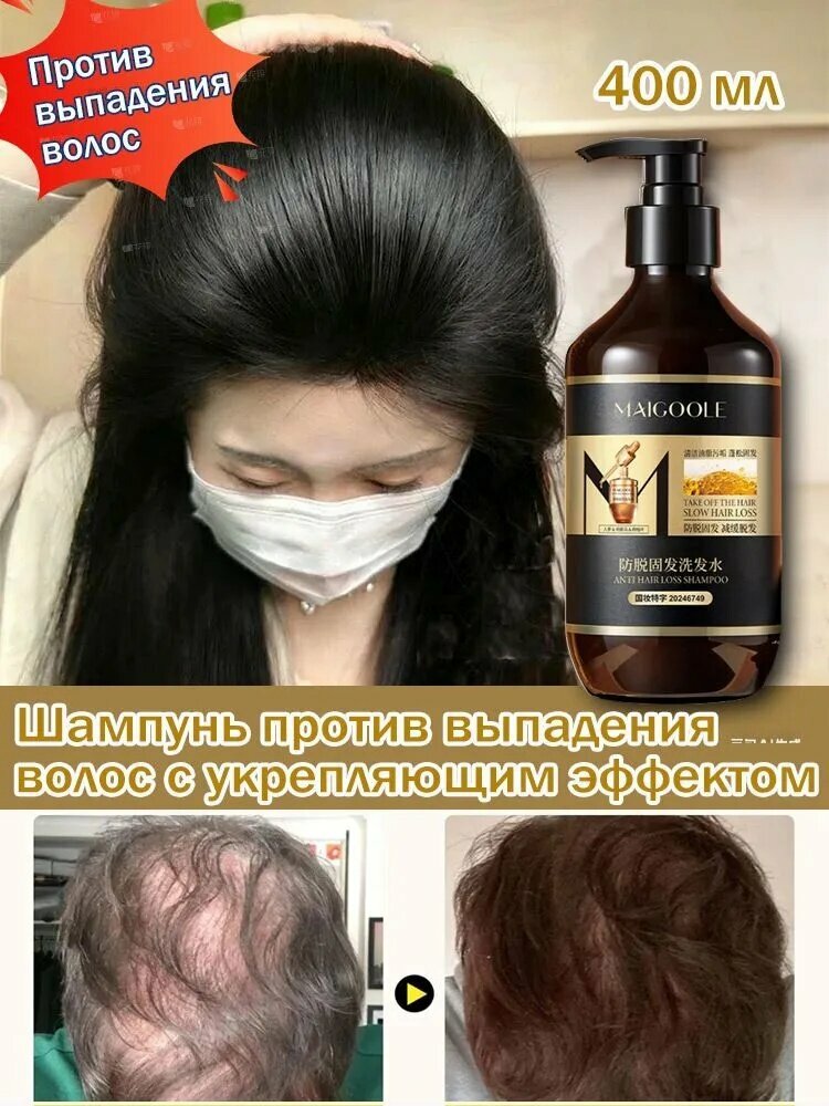 Шампунь с полигонумом многоцветным против выпадения волос, 400 мл. Питает кожу головы, предотвращает выпадение, эффективно очищает от перхоти и делает волосы гладкими и послушными.